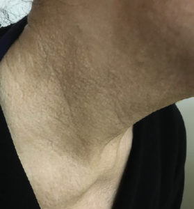 Yellow to orange skin lesions | Dermatology Games